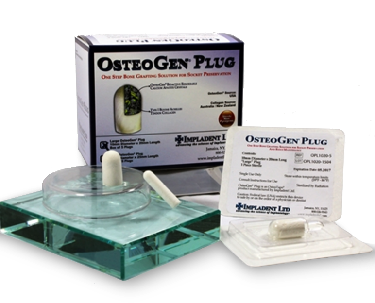 Regeneratives – Implant Logistics