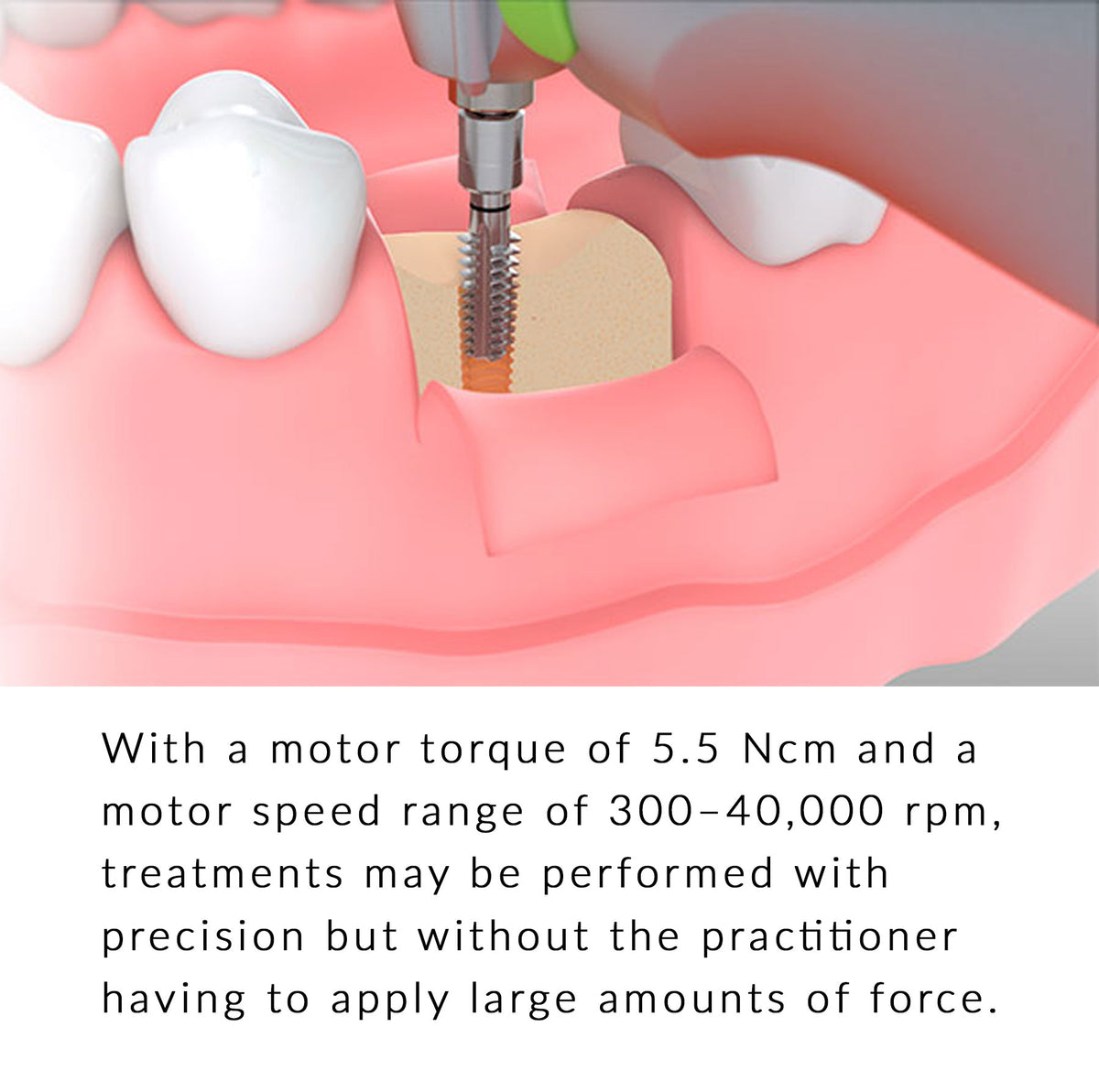 W & H Implantmed Classic with handpiece – Implant Logistics